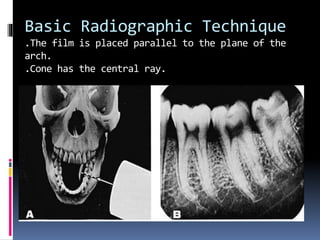 SLOB Technique | PPTX