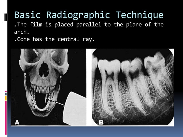 SLOB Technique | PPTX
