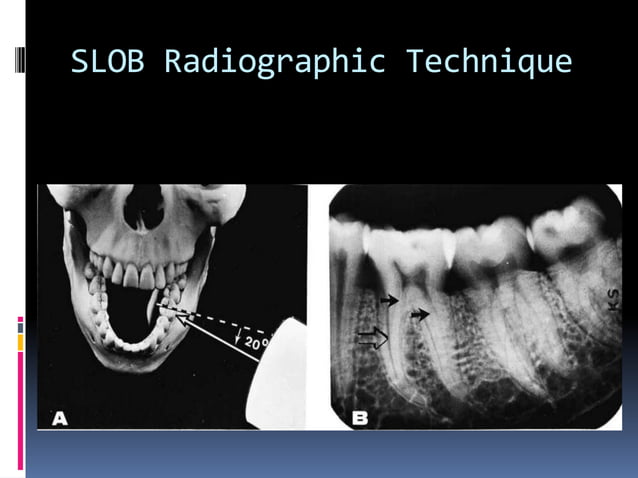 SLOB Technique | PPTX