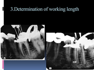 SLOB Technique | PPTX