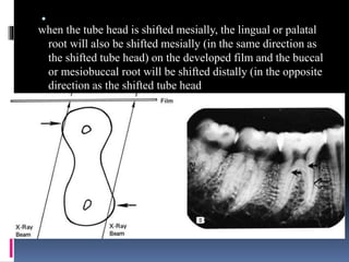 SLOB Technique | PPT