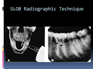 SLOB Technique | PPT