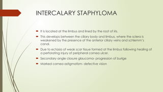 PRESENTATION_ON_STAPHYLOMA [2].pptx
