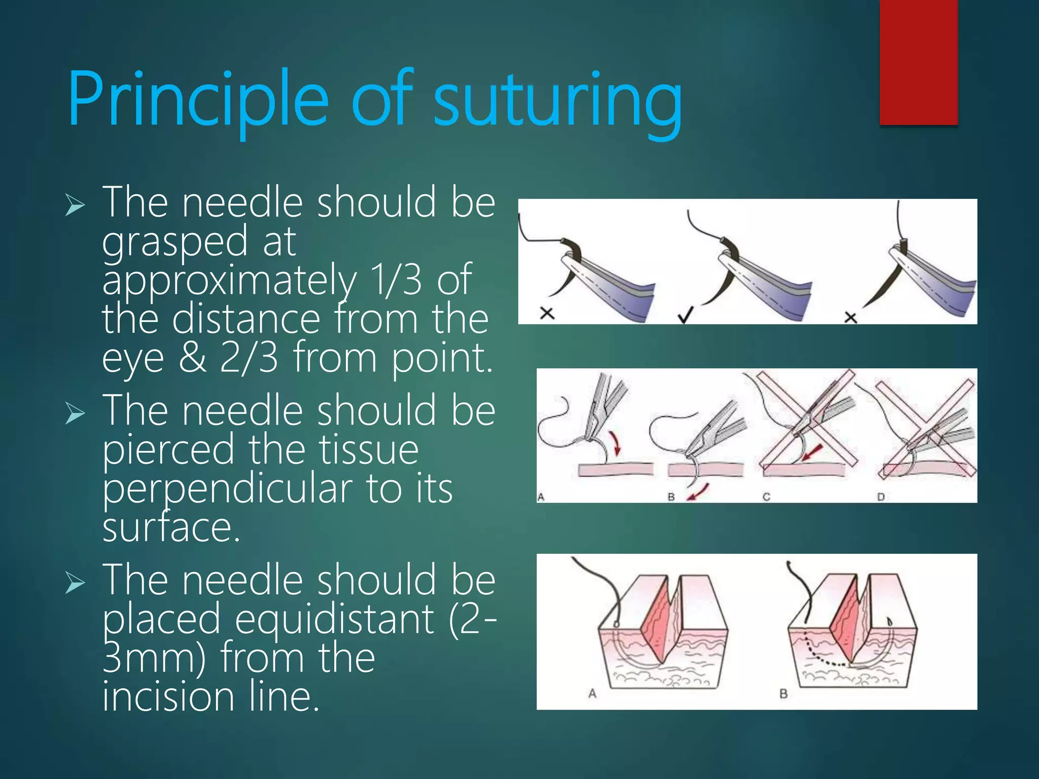 Suture Materials and Suturing Techniques | PPTX