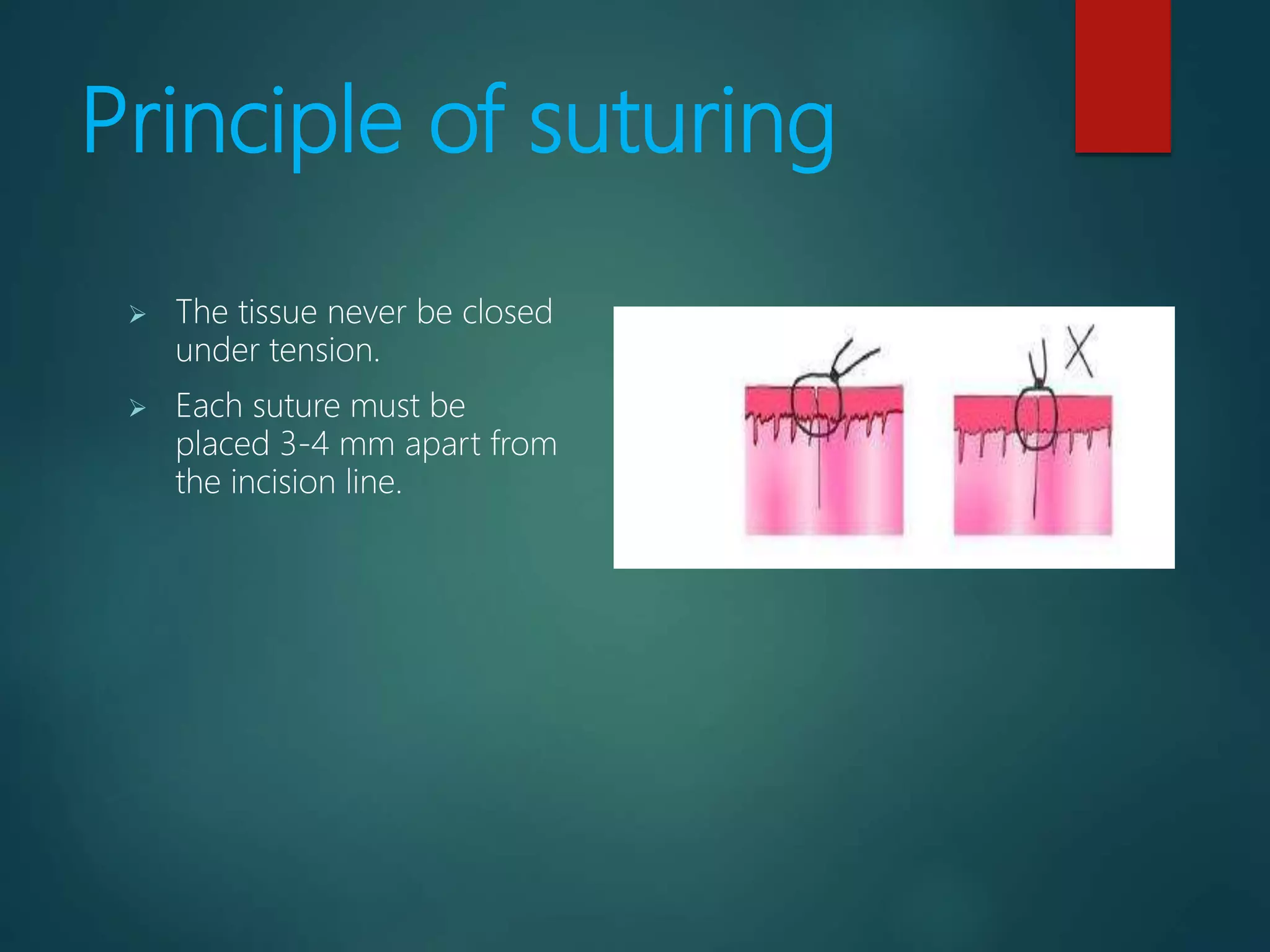Suture Materials and Suturing Techniques | PPTX