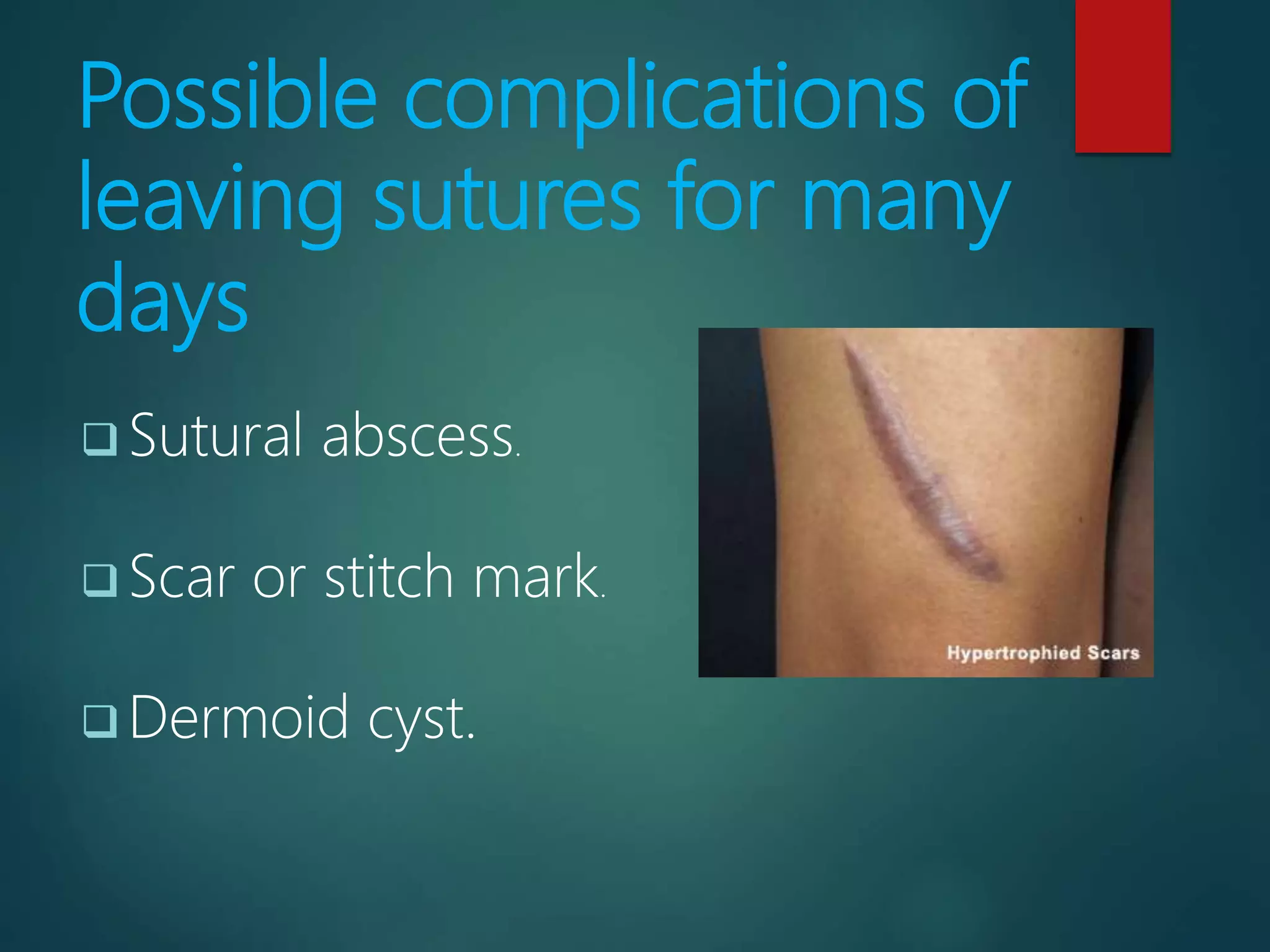 Suture Materials and Suturing Techniques | PPTX