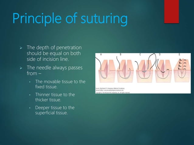 Suture Materials and Suturing Techniques | PPTX | First Aid | Injuries