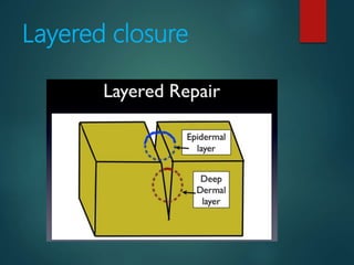 Suture Materials and Suturing Techniques | PPTX