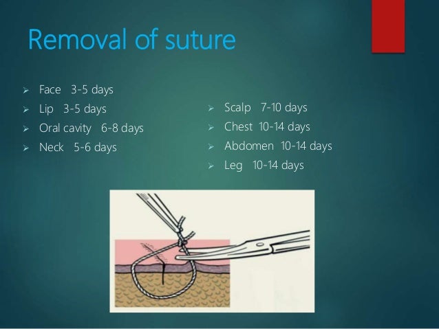 Suture Materials and Suturing Techniques