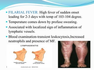 Filariasis (WUCHERERIA BANCROFTI) | PPTX