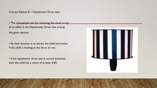 Questions and answers in ophthalmology 20 qna | PPTX