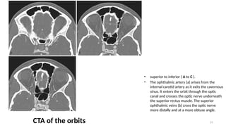Presentation on Radiological Anatomy of the Orbit | PPTX