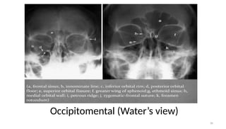 Presentation on Radiological Anatomy of the Orbit | PPTX