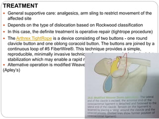 Acromioclavicular Joint Dislocation | PPTX