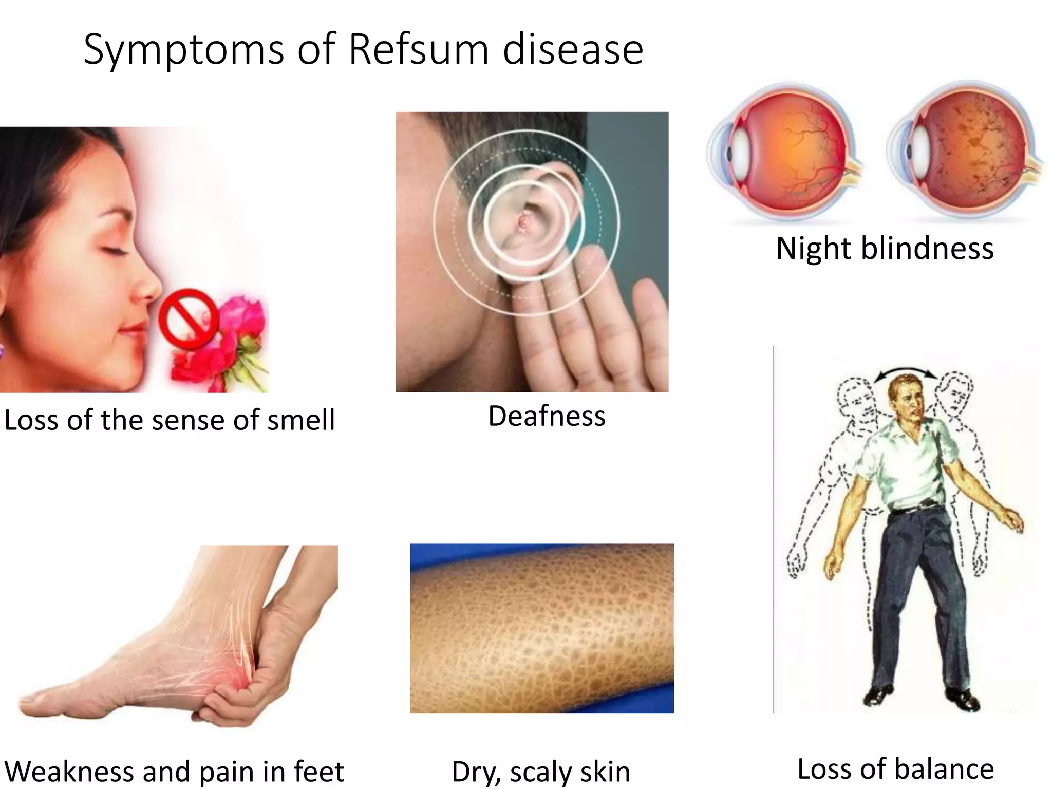 Phytanic acid pathway and Refsum disease | PPTX