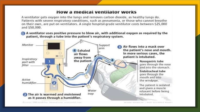 care of child on ventilator | PPSX | Lung and Respiratory Health ...