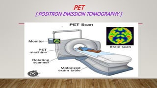 pet scan.ppt