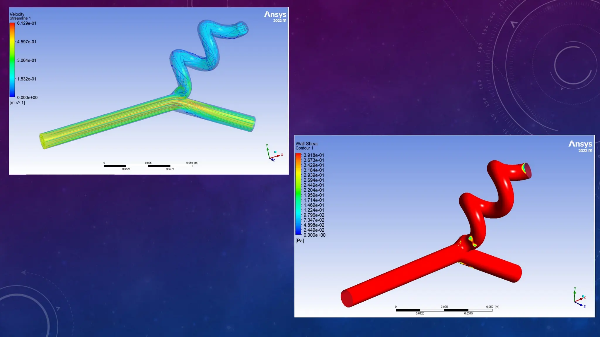 Project Phase presentation of CFD in Bio medical field using Ansys ...