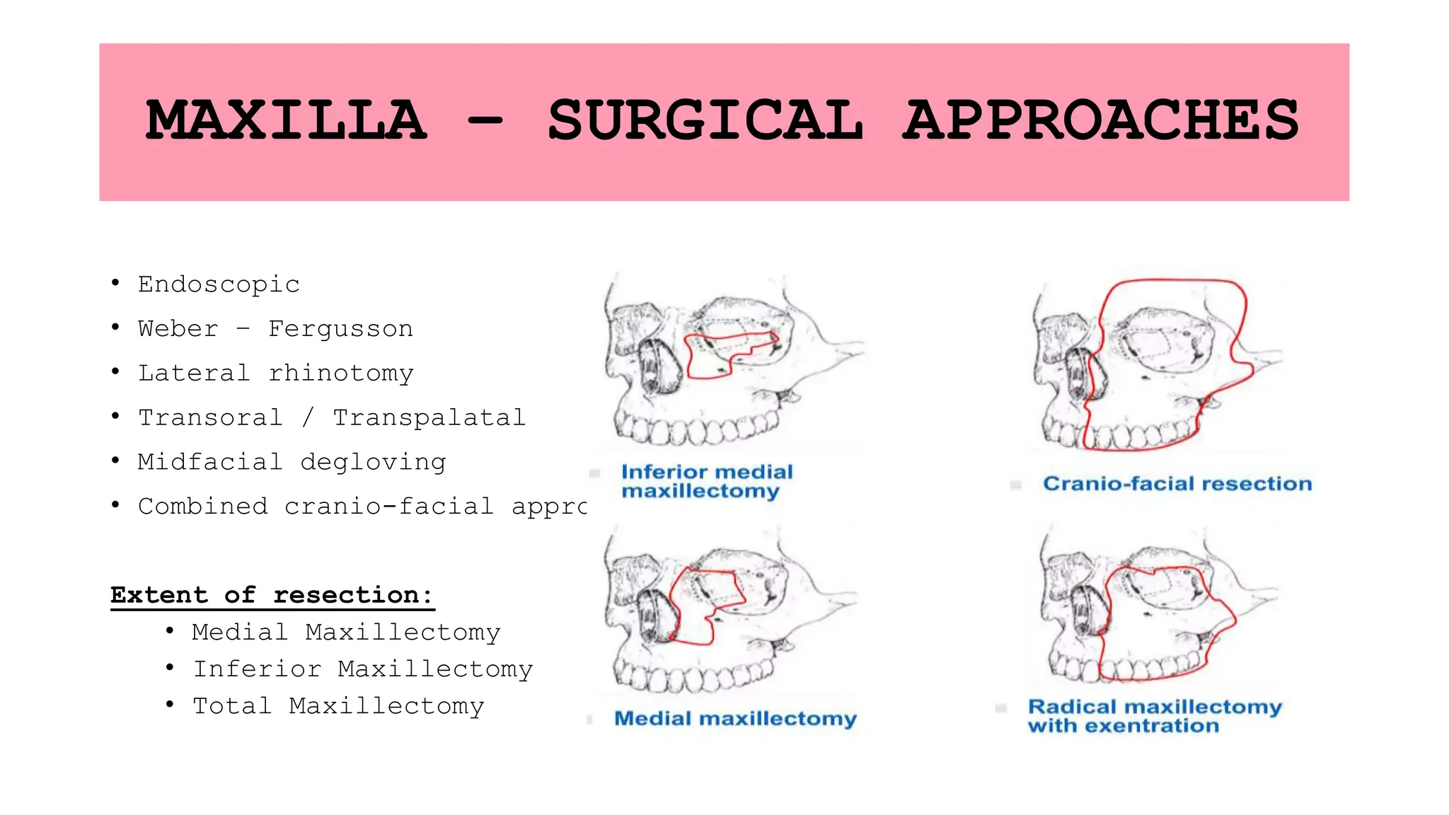 Paranasal sinus tumours - management principles | PPTX