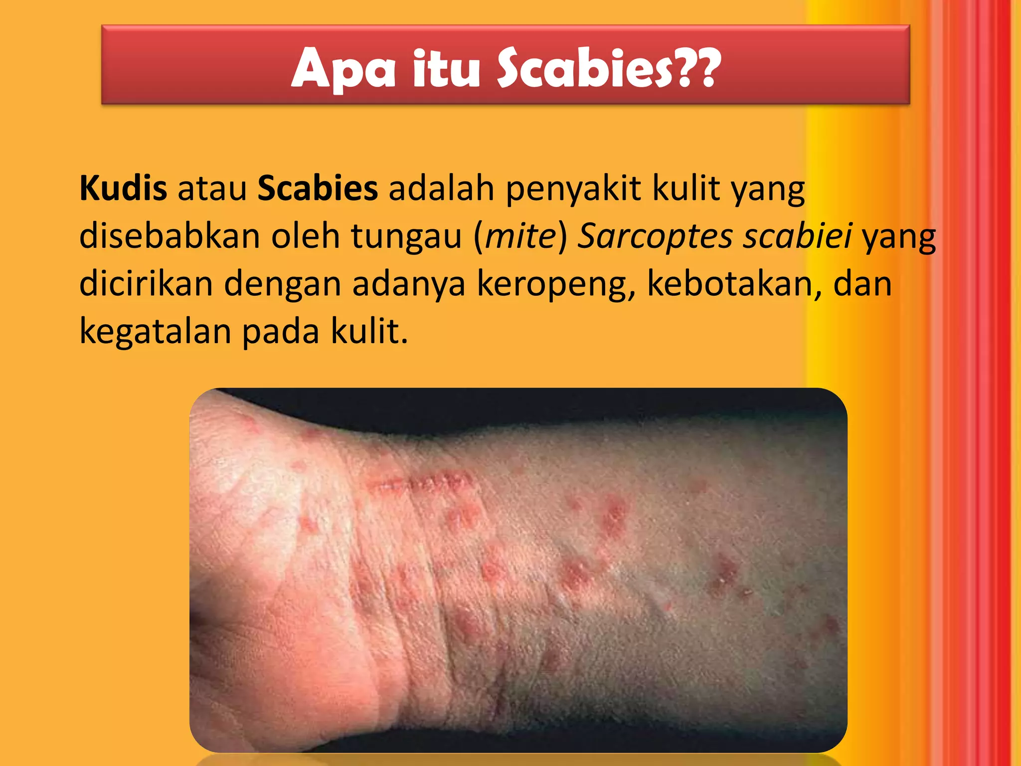 penyuluhan kesehatan di ponpes | PPTX