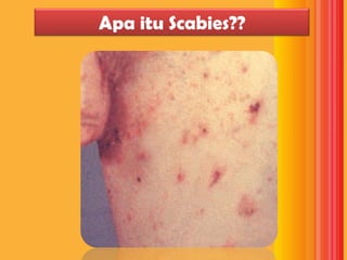 penyuluhan kesehatan di ponpes | PPTX