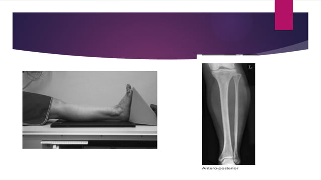 positioning presentation (radiology).pptx