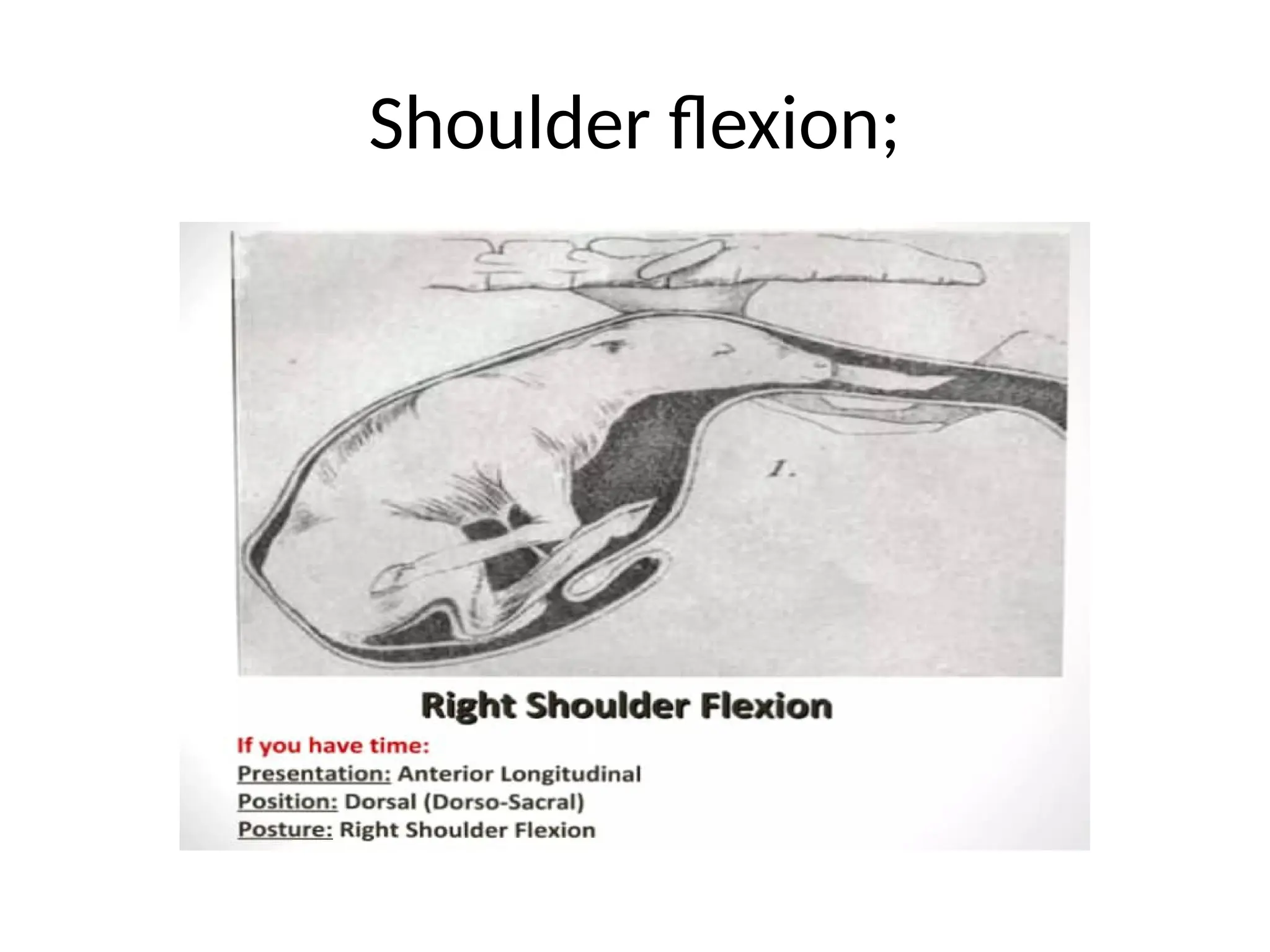 presentation,position,posture In Veterinary Obstetrics | PPTX