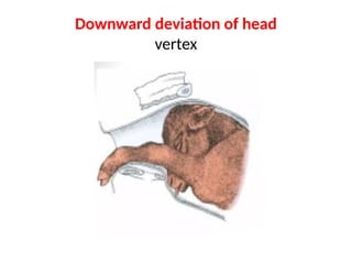 presentation,position,posture In Veterinary Obstetrics | PPTX