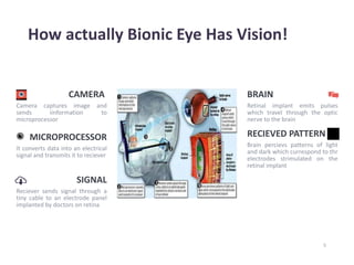 Short presentation on 'BIONIC EYES' | PPT