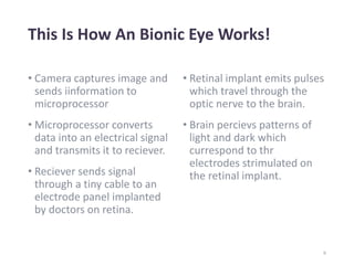 Short presentation on 'BIONIC EYES' | PPT