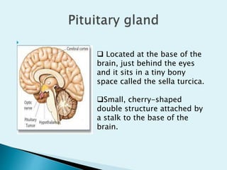 Presentation on Pituitary Gland Tumor | PPTX