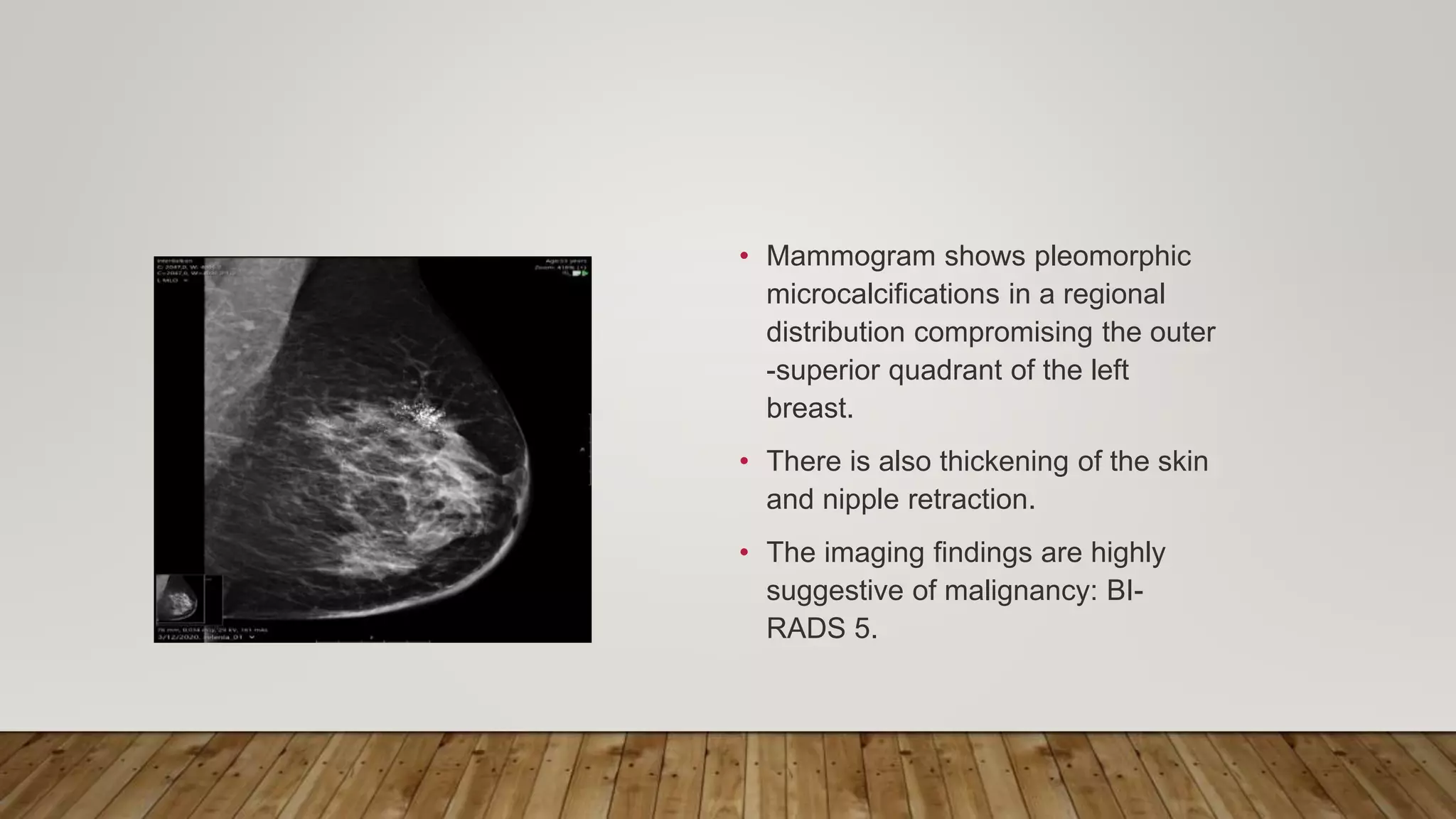 Birads classification of breast.pptx