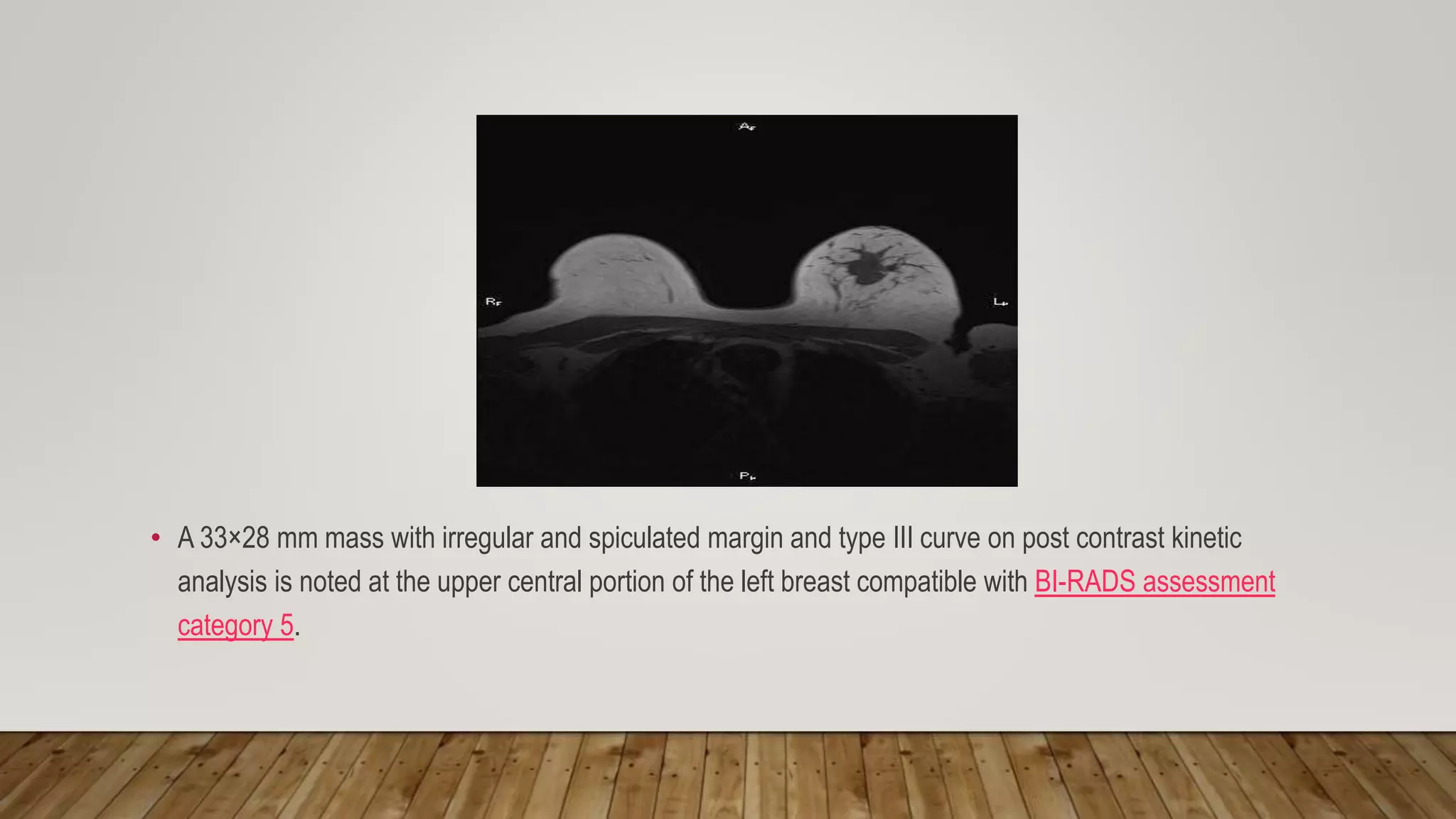 Birads classification of breast.pptx