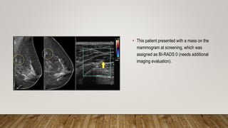 Birads classification of breast.pptx