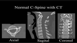 approach to radiology of spinal cord.pptx