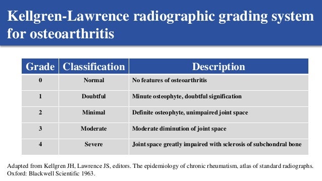 Presentation on Joints (Medical)