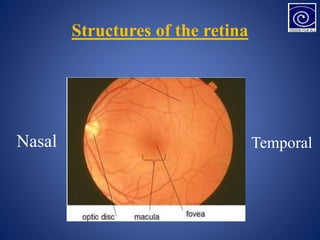 Presentation Retina.pptx