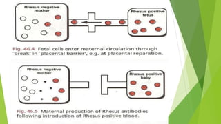 Presentation Rh Incompatibility.pdf