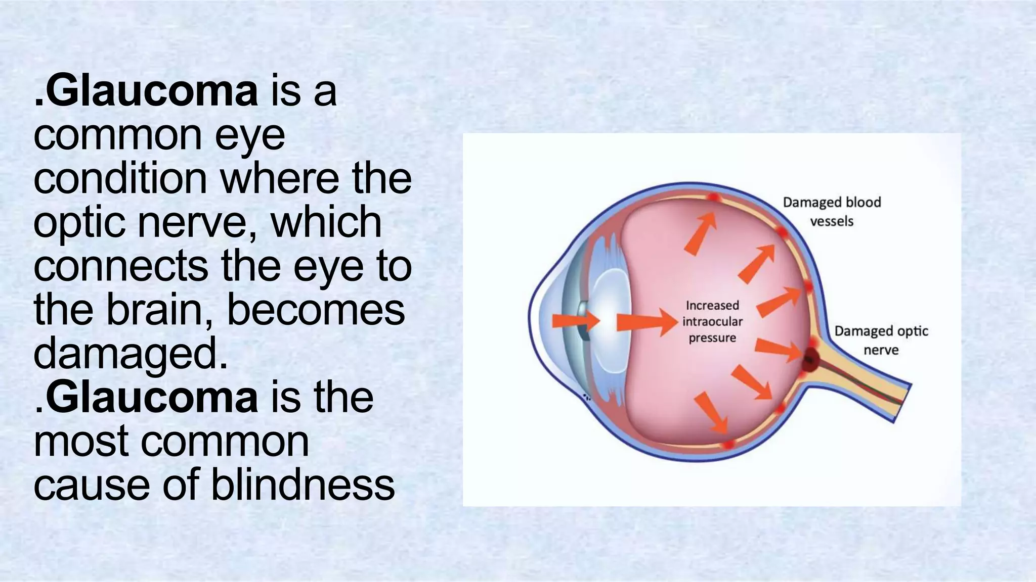 Autonomic innervation of the eyes and strategies used to treat Glaucoma ...