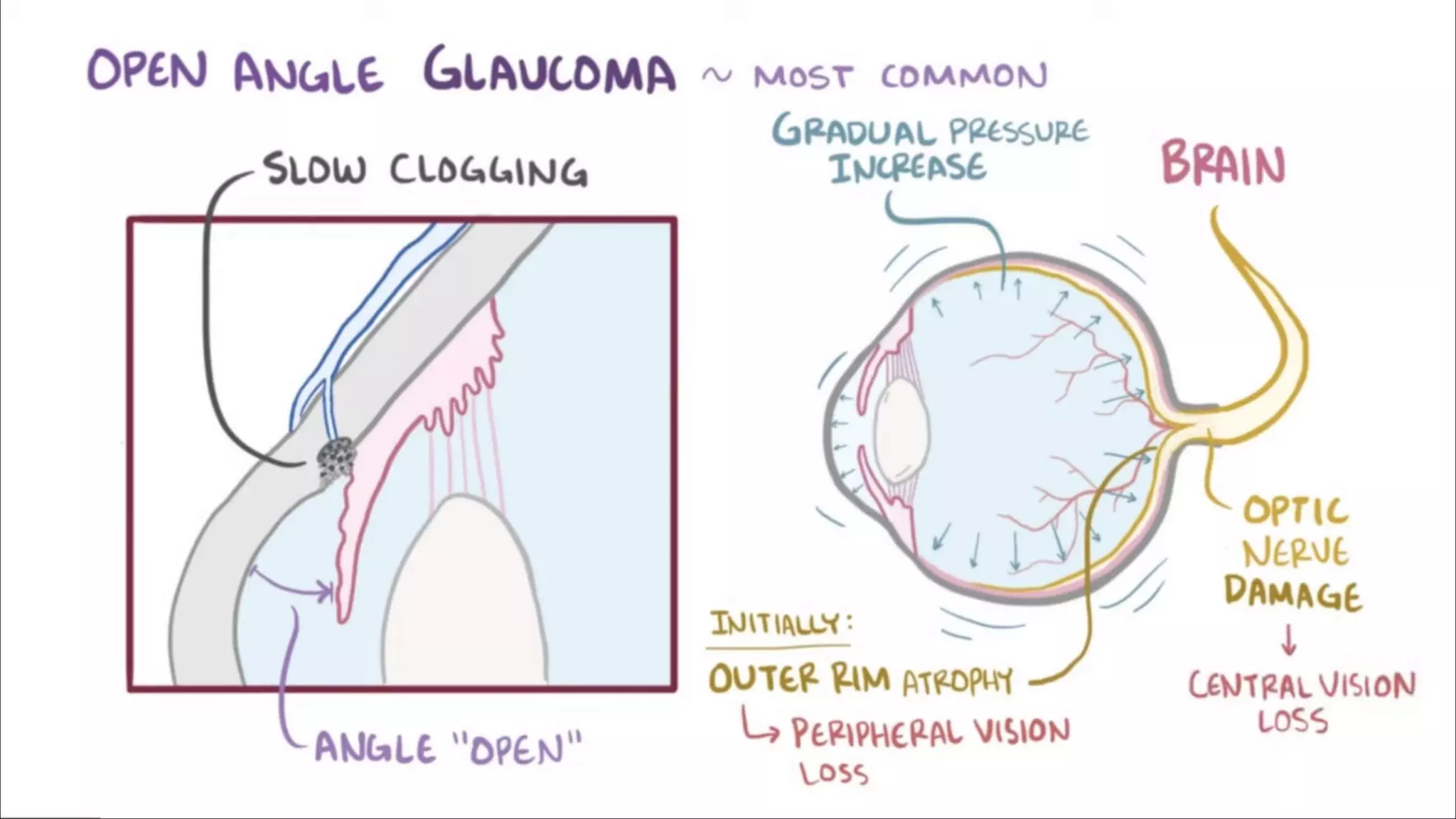 Autonomic innervation of the eyes and strategies used to treat Glaucoma ...