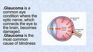 Autonomic innervation of the eyes and strategies used to treat Glaucoma ...
