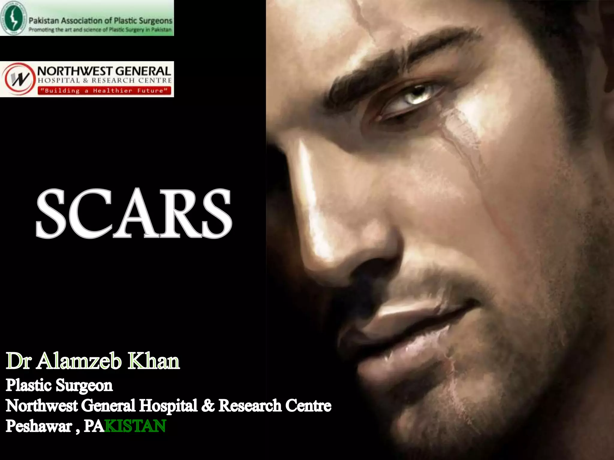 Presentation scars | PPTX