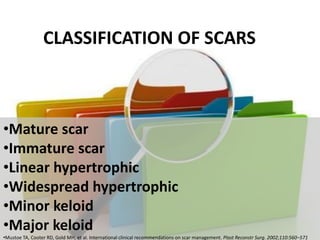 Presentation scars | PPT