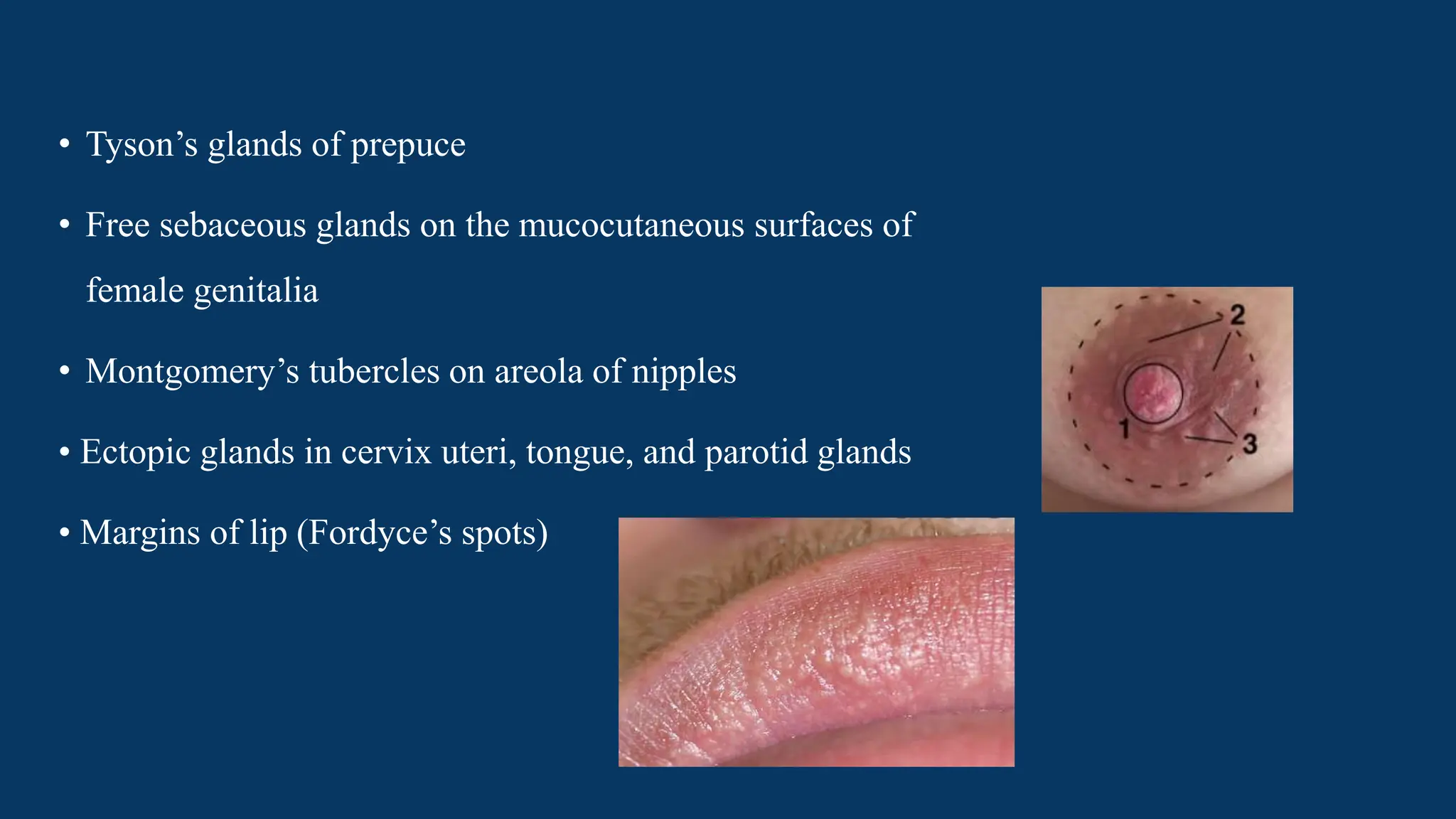 Anatomy and physiology of sebaceous glands.pptx