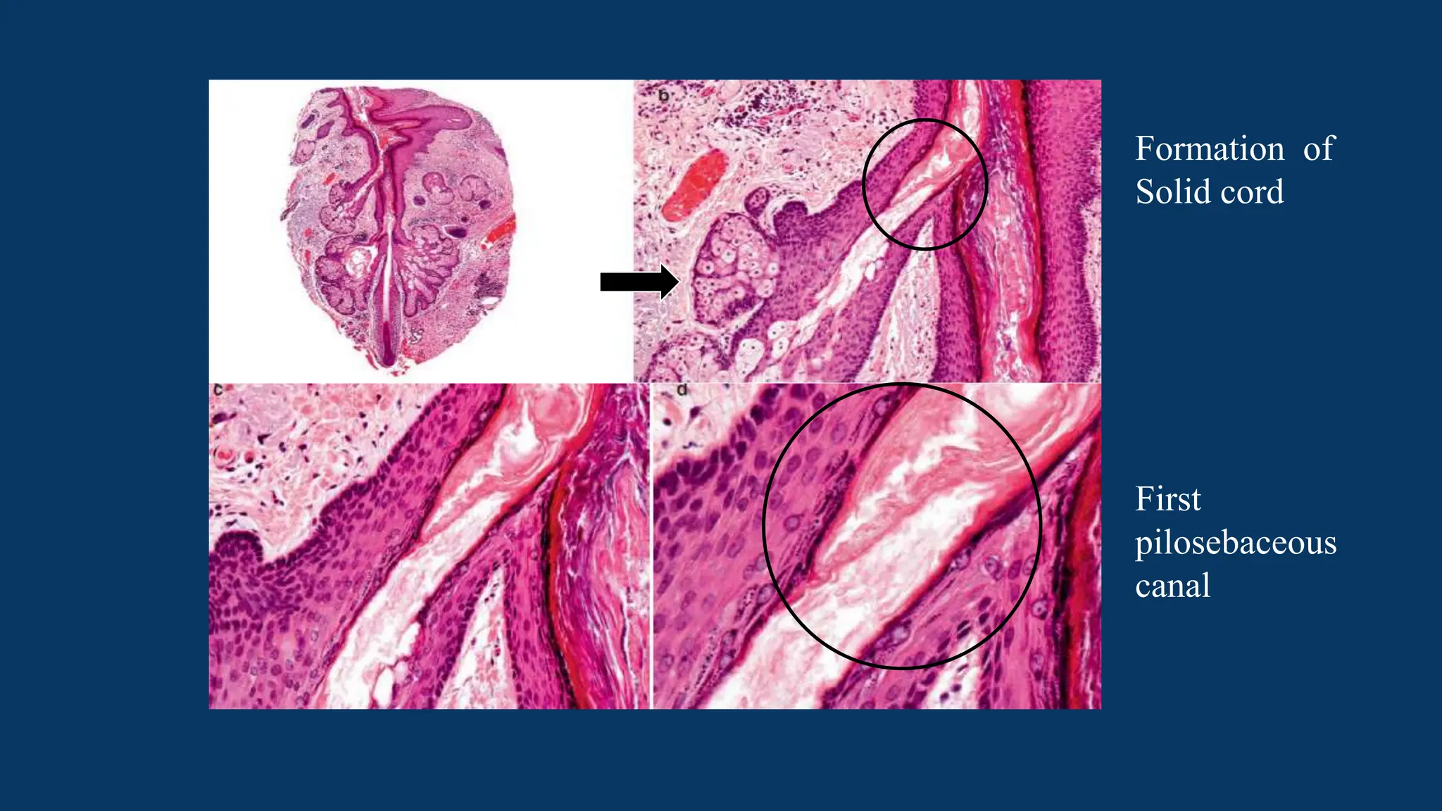 Anatomy and physiology of sebaceous glands.pptx