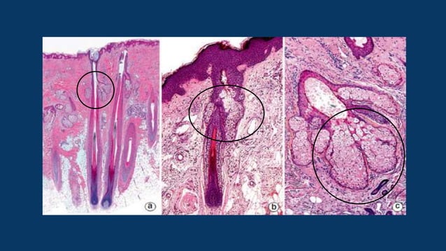 Anatomy and physiology of sebaceous glands.pptx | Genetics | Science