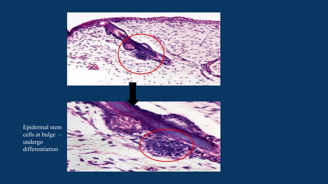 Anatomy and physiology of sebaceous glands.pptx | Genetics | Science