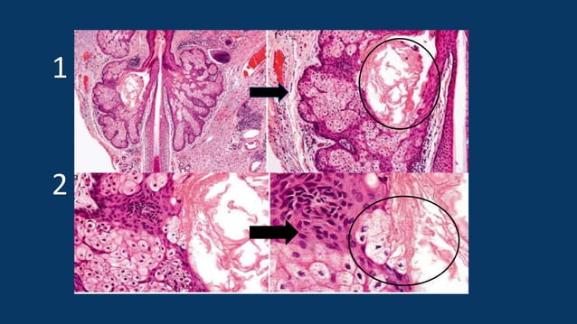 Anatomy and physiology of sebaceous glands.pptx | Genetics | Science