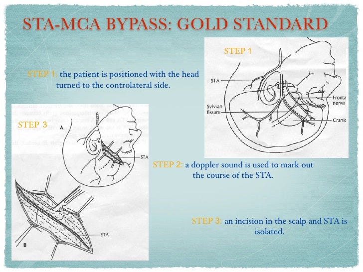 marta salis skullbase