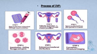 IVF and Assisted Reproductive Techniques, Its ethical concerns | PPTX